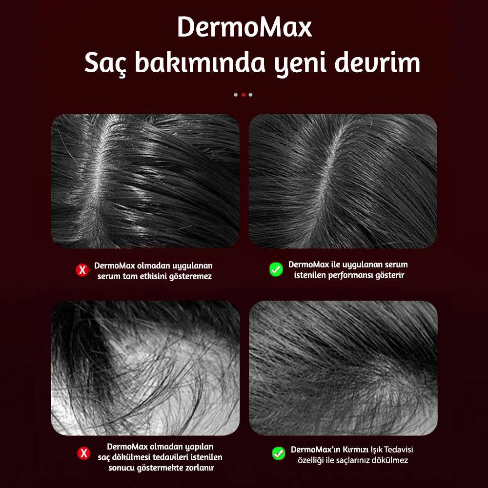 DermoMax – dermomax